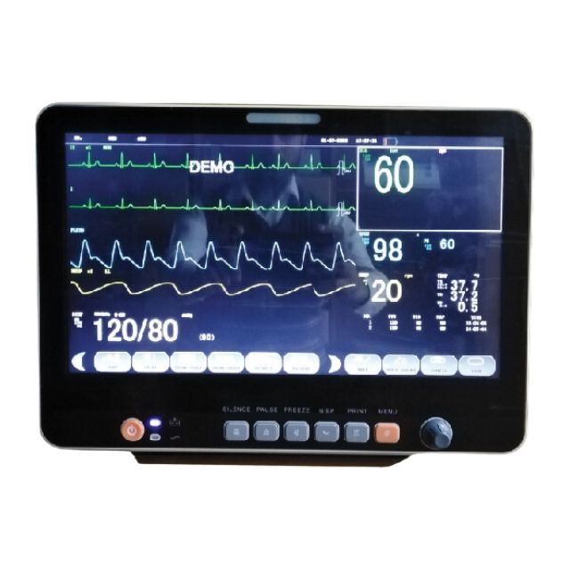EMS-15000A Patient Monitor – Esonic – V Shop